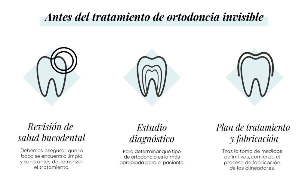 Cómo es el tratamiento de ortodoncia invisible - Dentisana